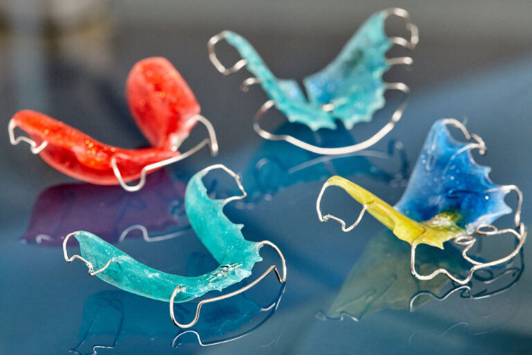 How Are Retainers Made? - Charleston Orthodontics Powered By Smile Doctors
